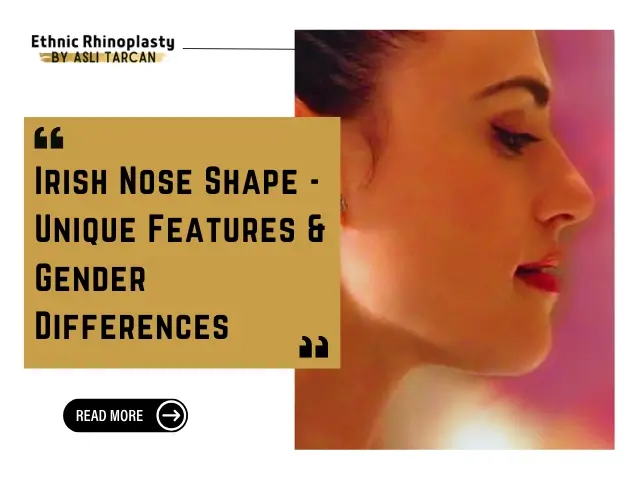 Irish Nose Shape - Unique Features & Gender Differences