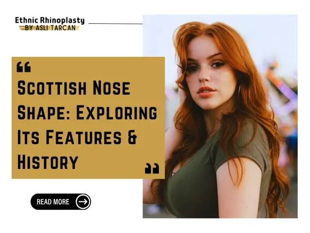 Scottish Nose Shape: Exploring Its Features & History