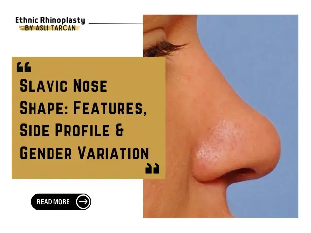 Slavic Nose Shape: Features, Side Profile & Gender Variation