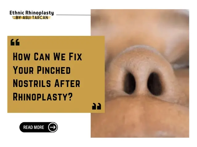 How Can We Fix Your Pinched Nostrils After Rhinoplasty?
