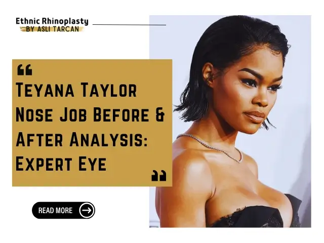 Teyana Taylor Nose Job Before & After Analysis: Expert Eye